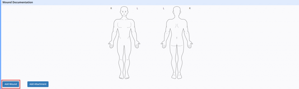 Wound Body Diagram in Skilled Nurse Visits in Axxess Hospice
